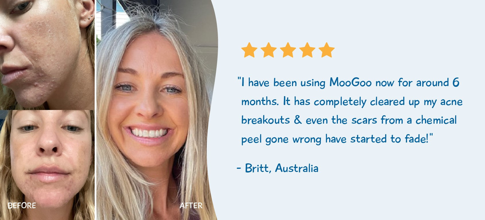 MooGoo Face – MooGoo USA